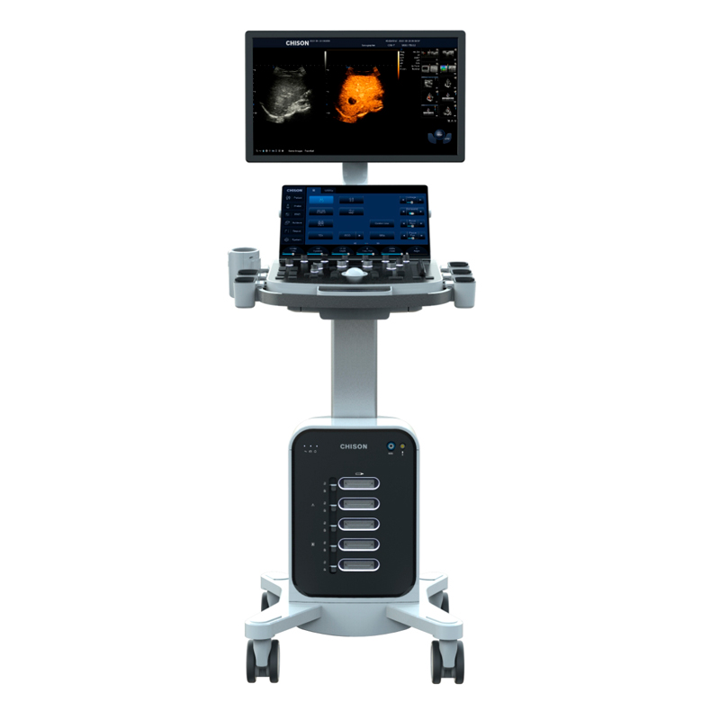 Chison SonoMax Stationary Ultrasound Machine - Fisaude Store