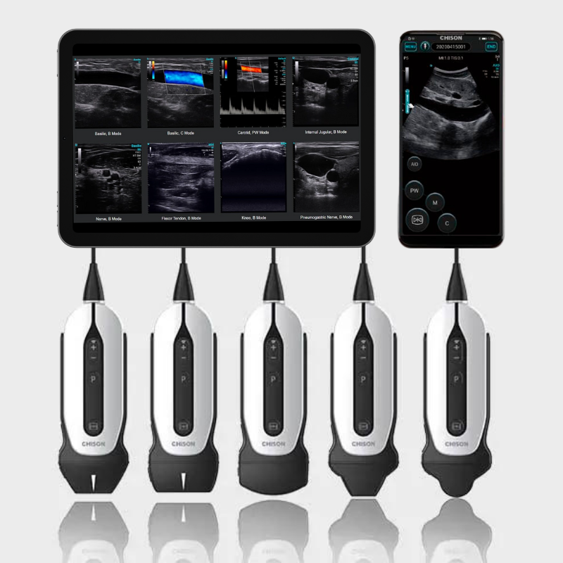 Chison SonoEye Portable Ultrasound + Xiaomi Redmi Pad SE Tablet as a ...