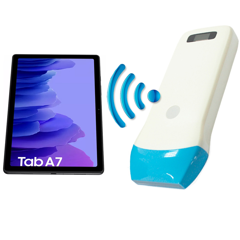 Sonostar wireless portable color doppler ultrasound scanner with ...